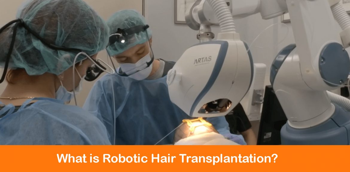 What is Robotic Hair Transplantation? - Zenhair Turkiye